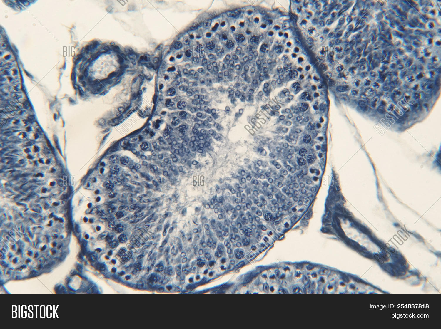 Human Testis Under Image & Photo (Free Trial) | Bigstock