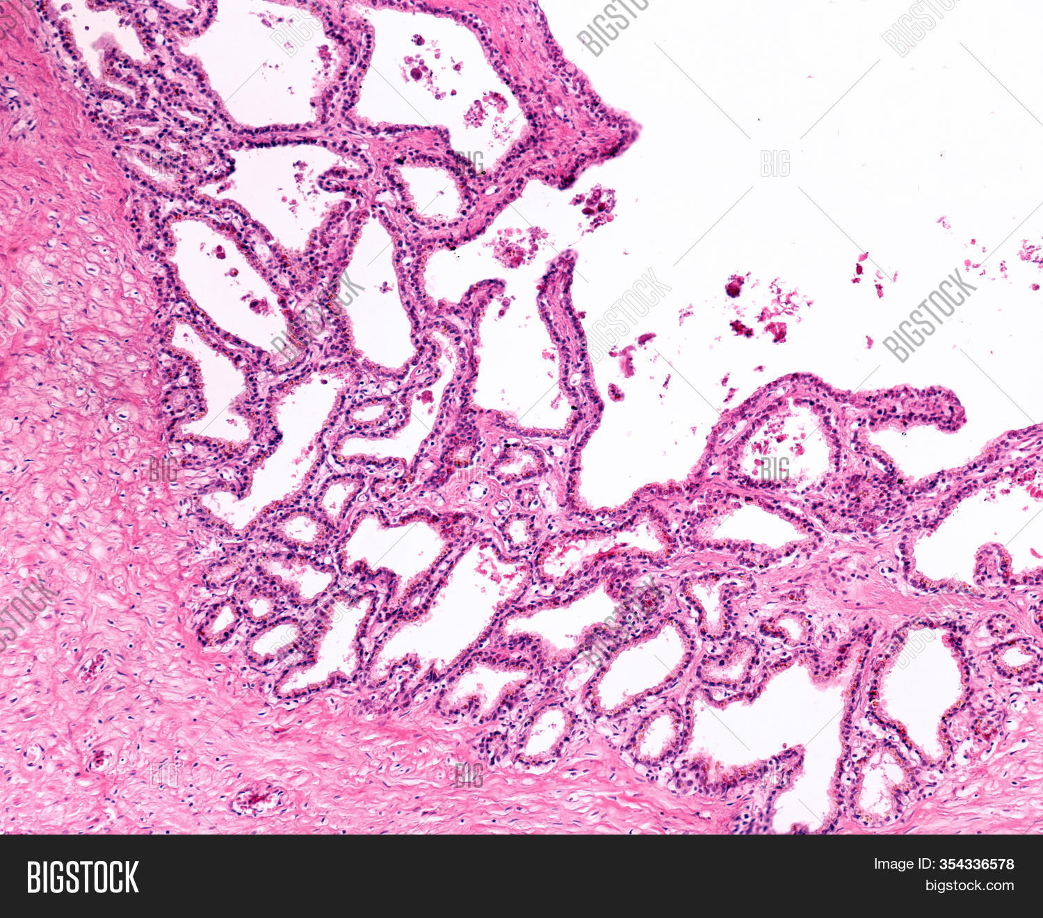 Wall Human Seminal Image & Photo (Free Trial) | Bigstock