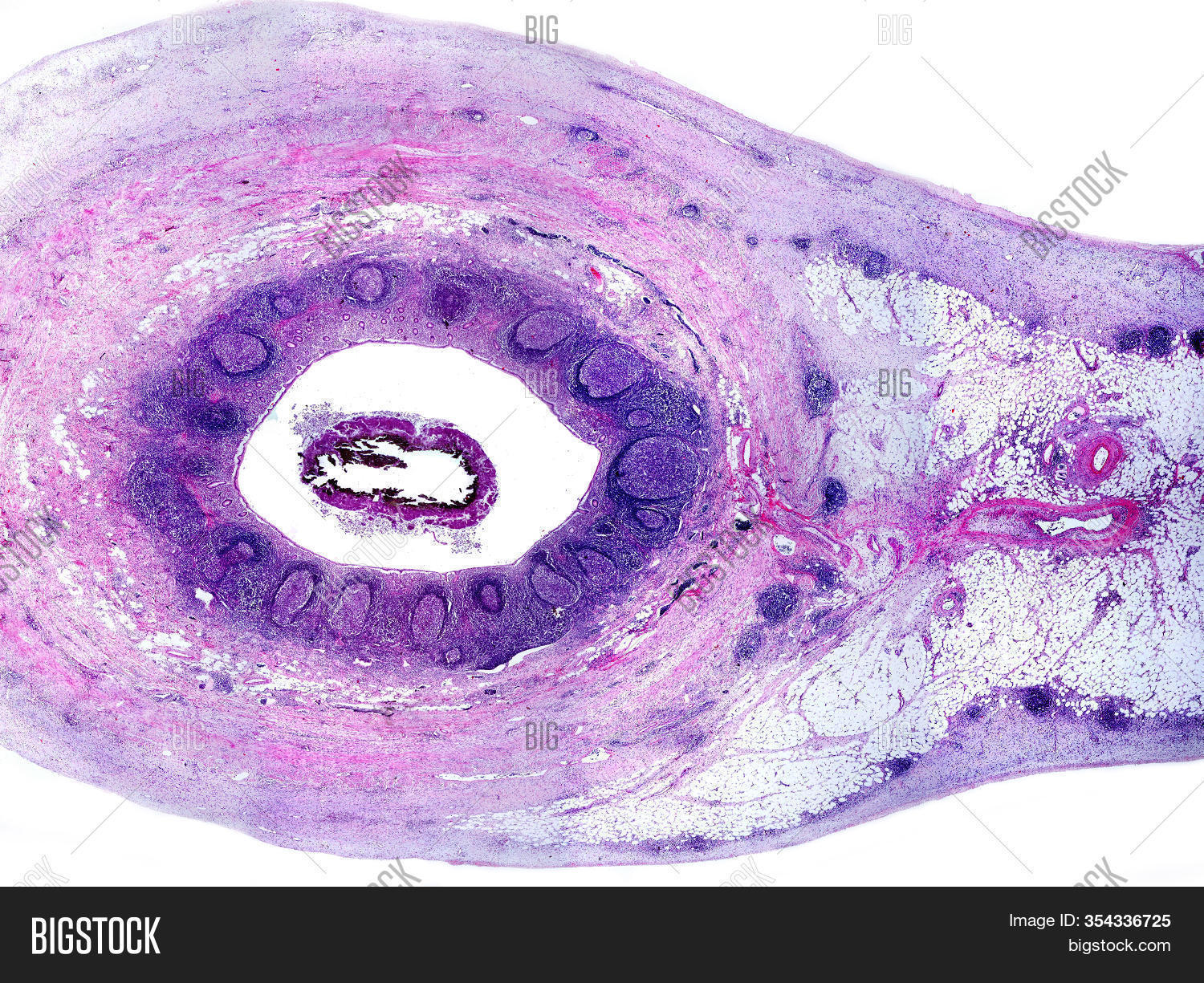 Vermiform Appendix Histology