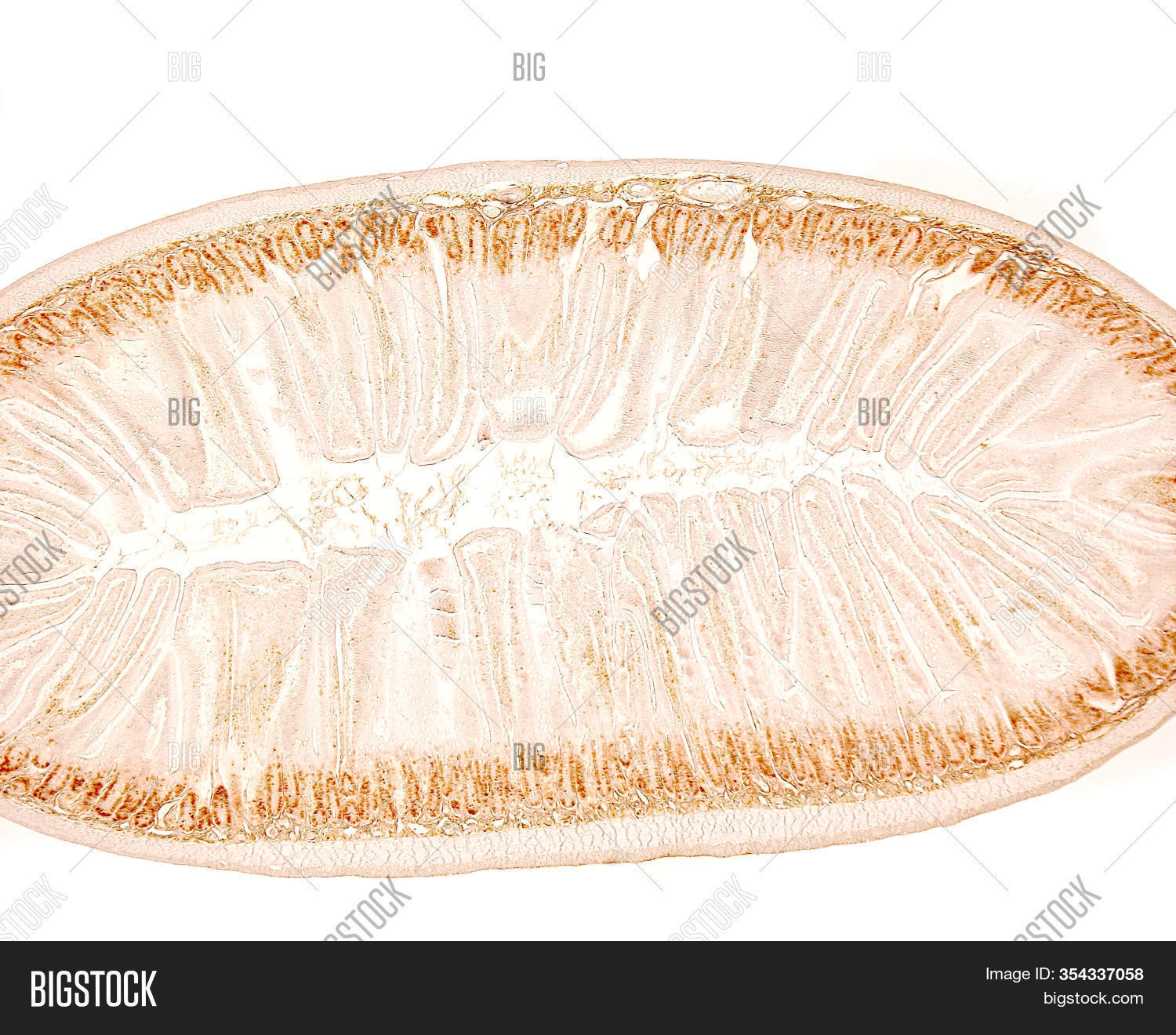 Small Intestine. Stem Image & Photo (Free Trial) | Bigstock
