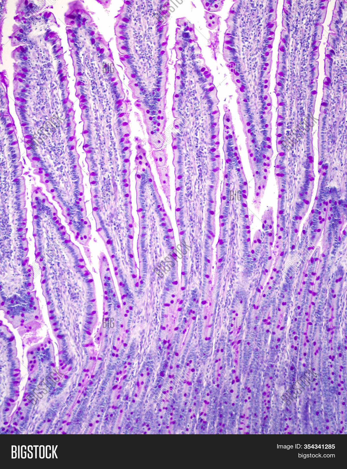 Mucosa Small Intestine Image & Photo (Free Trial) | Bigstock