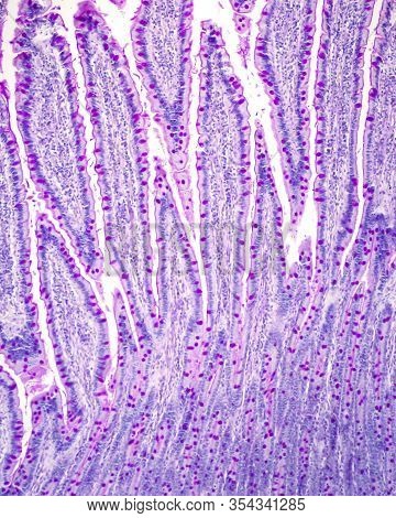 Mucosa Small Intestine Image & Photo (Free Trial) | Bigstock