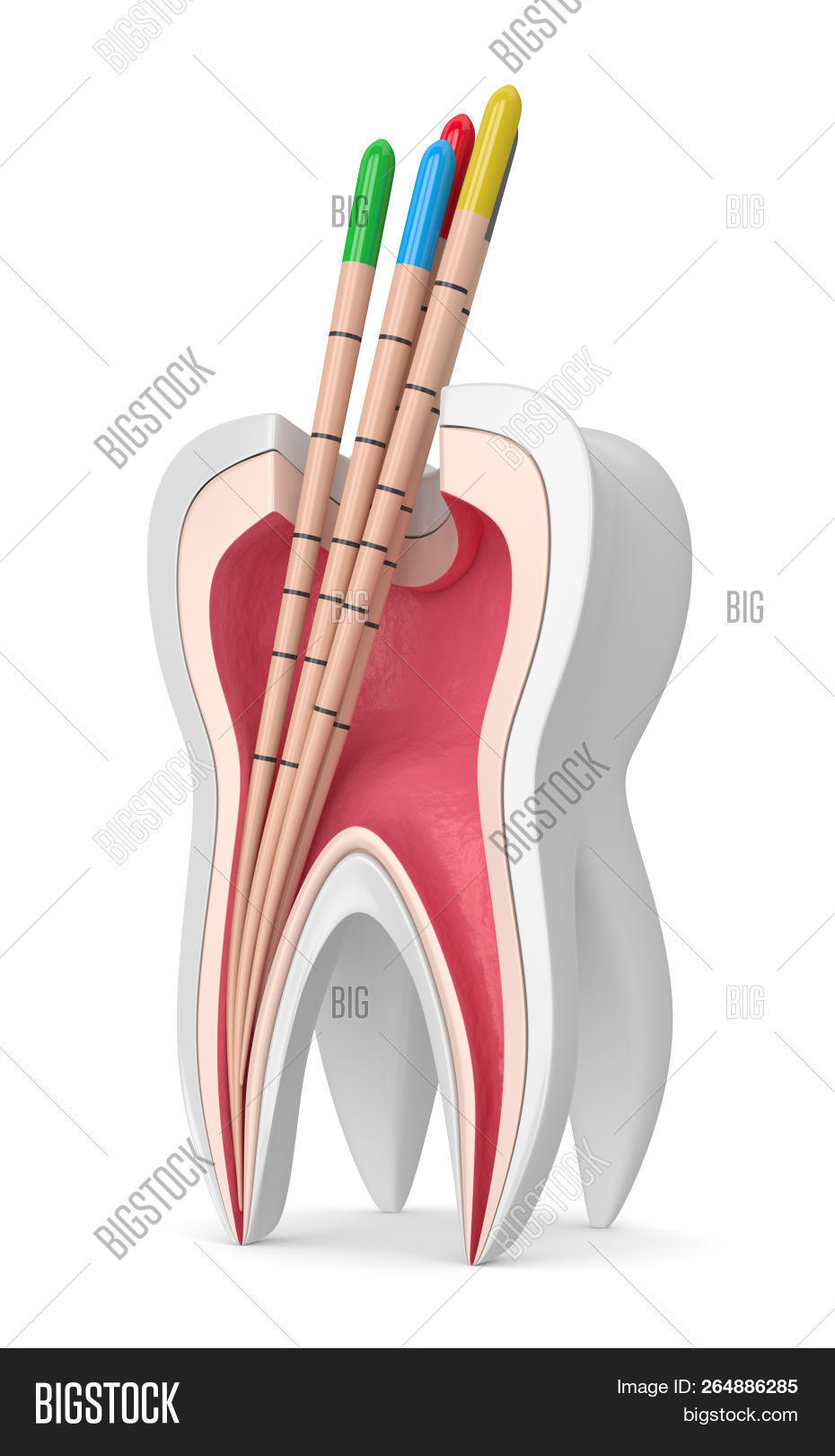 3D Render Tooth Gutta Image & Photo (Free Trial) | Bigstock