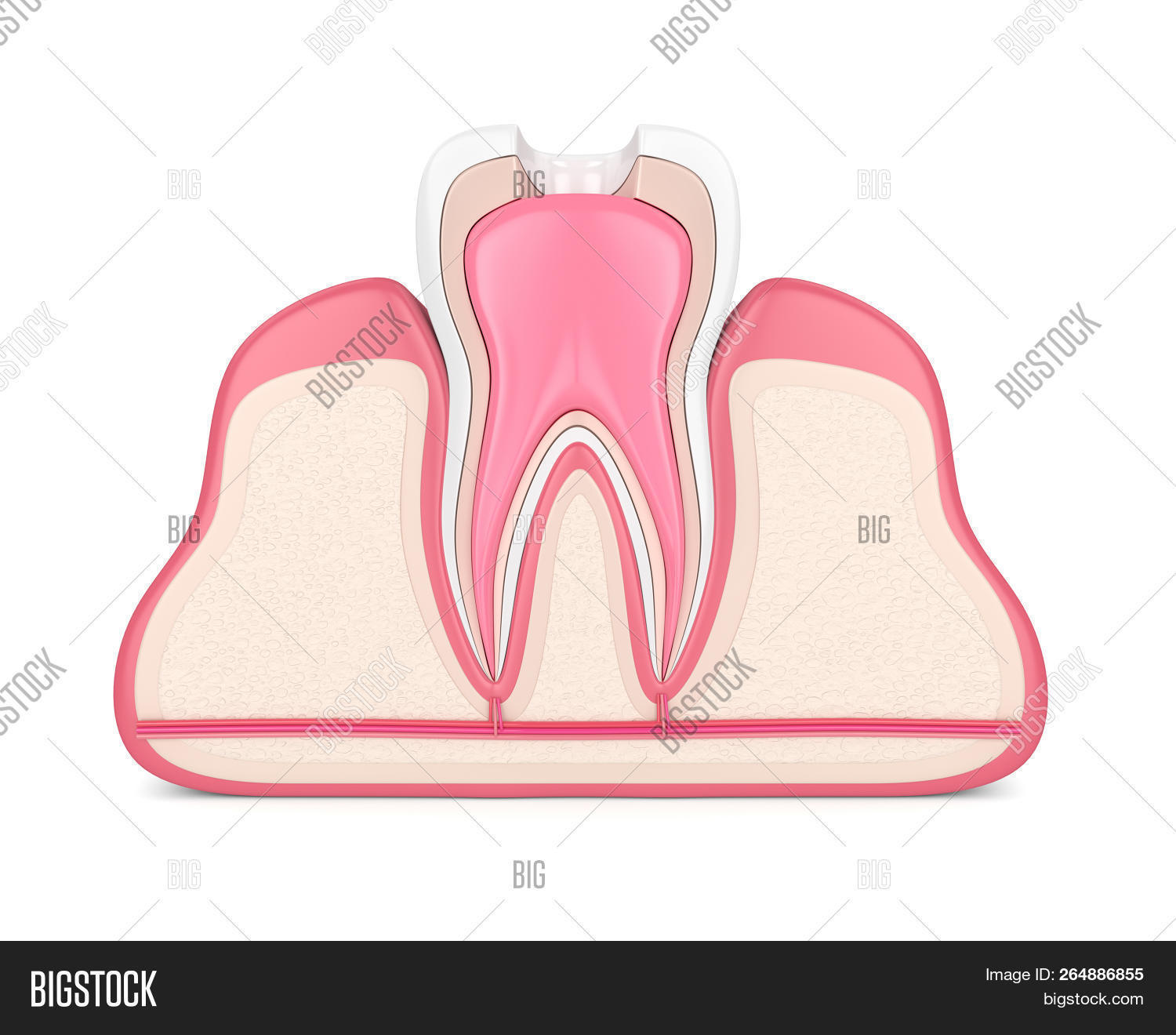 3D Render Tooth Root Image & Photo (Free Trial) | Bigstock