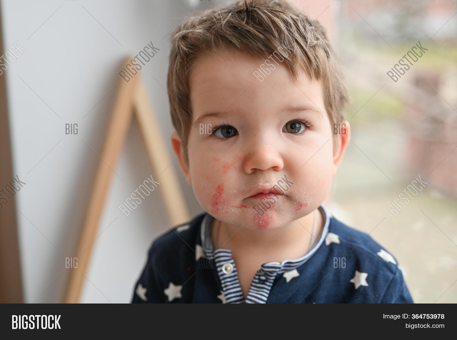 Child Has Rash On His Image & Photo (Free Trial) | Bigstock