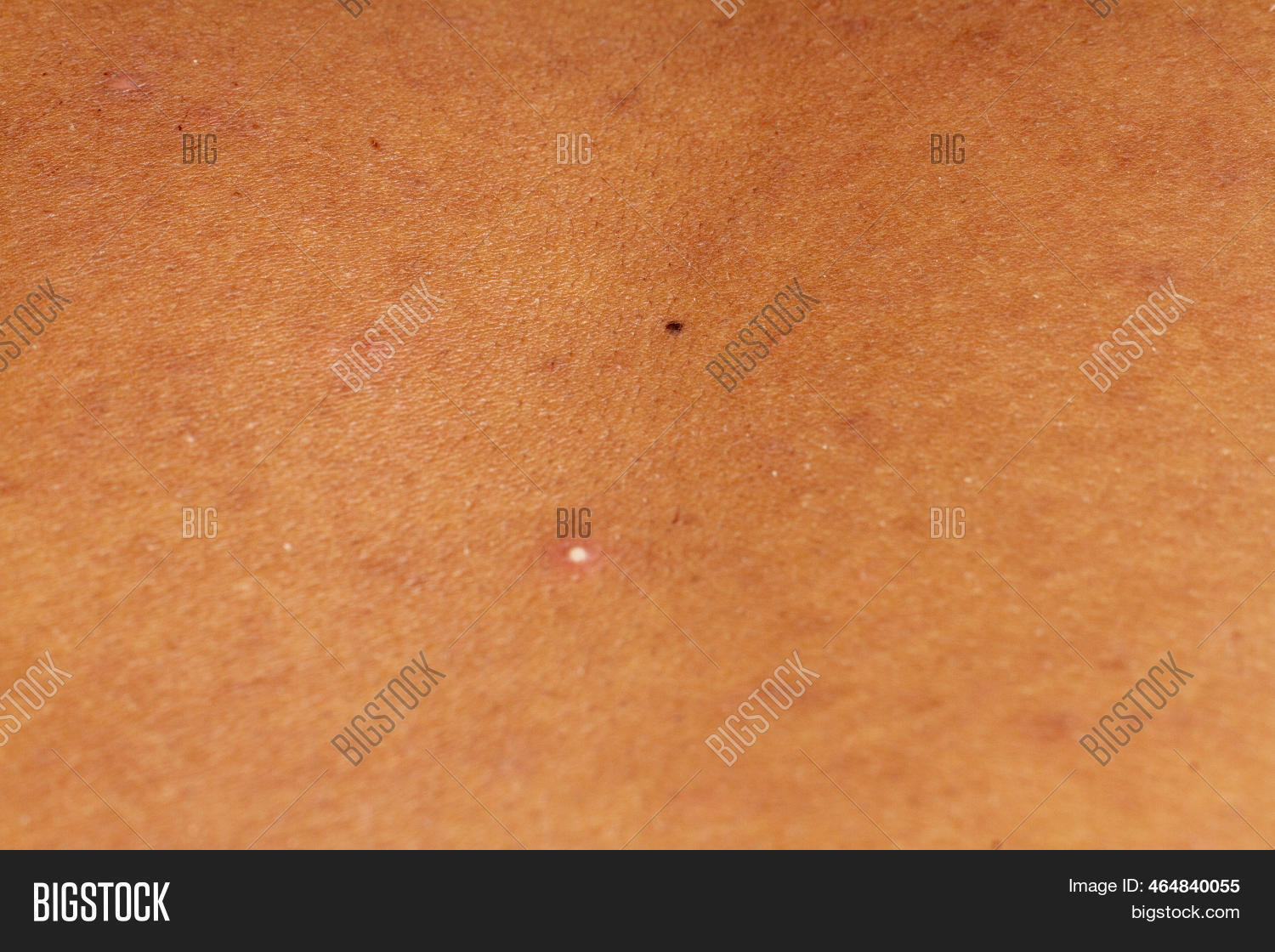 Human Skin Texture. Image & Photo (Free Trial) | Bigstock