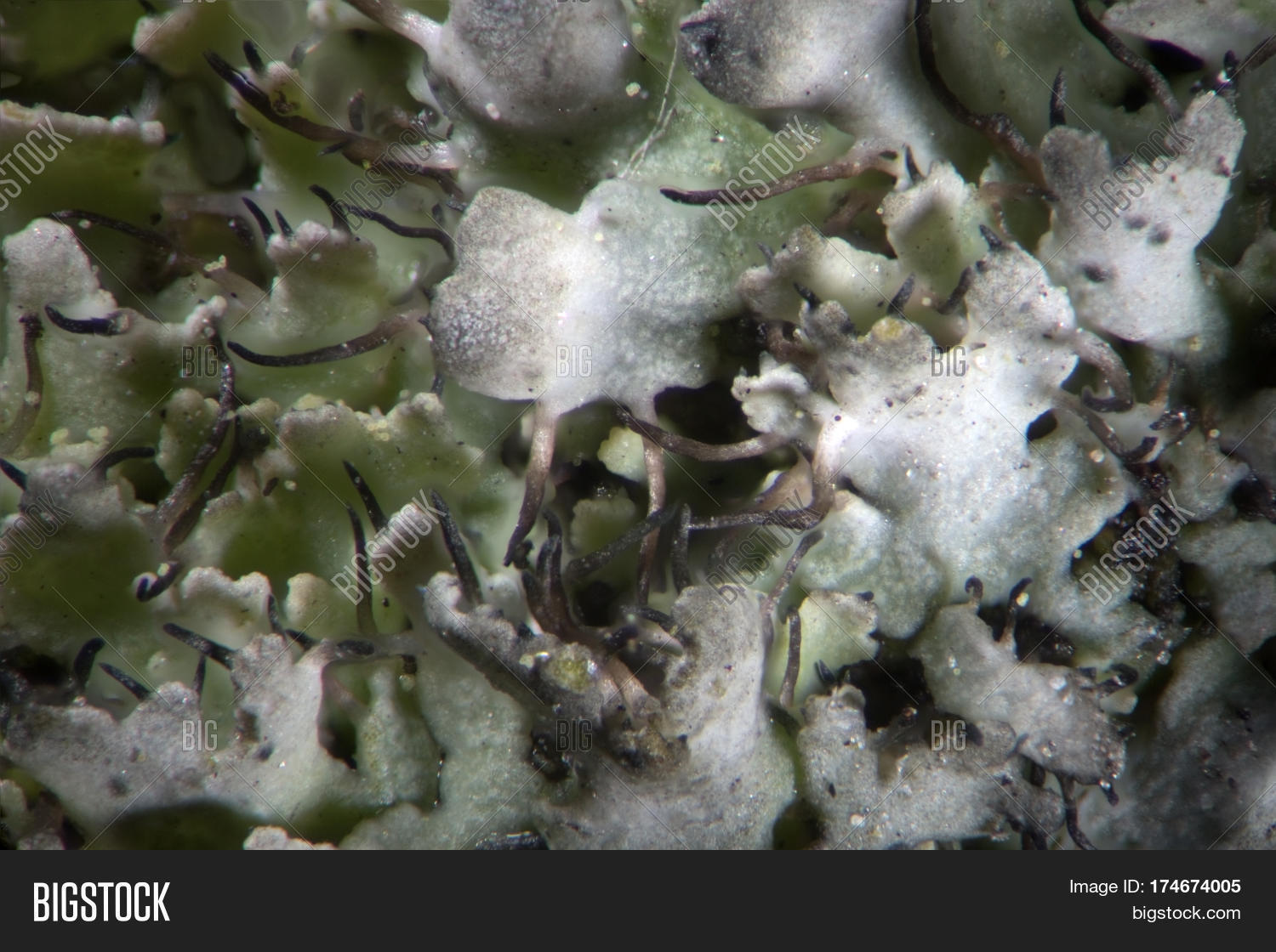 Microscopic Bushy Image & Photo (Free Trial) | Bigstock