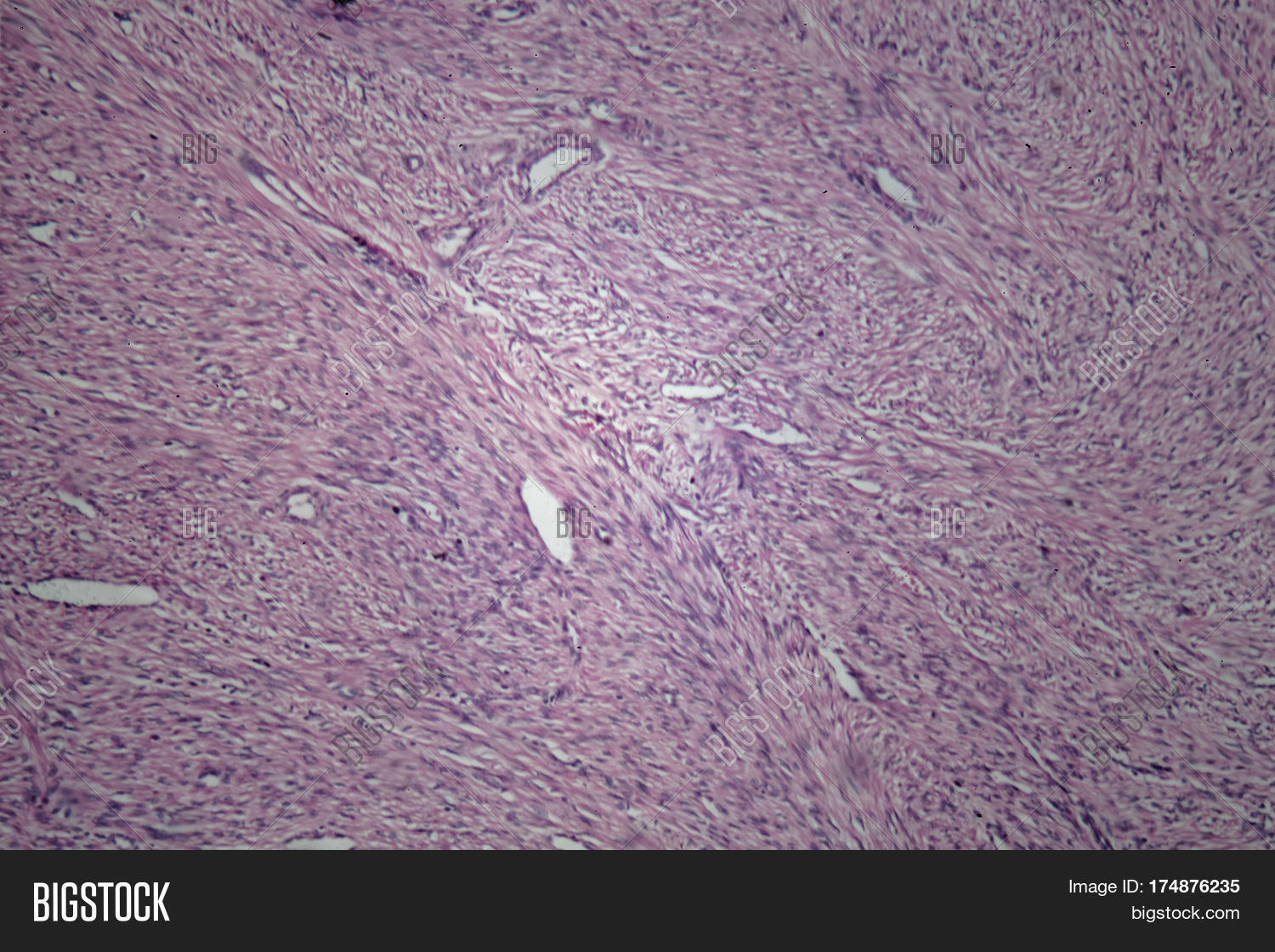 Cells Human Uterus Image & Photo (Free Trial) | Bigstock