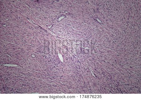 Cells Human Uterus Image & Photo (Free Trial) | Bigstock