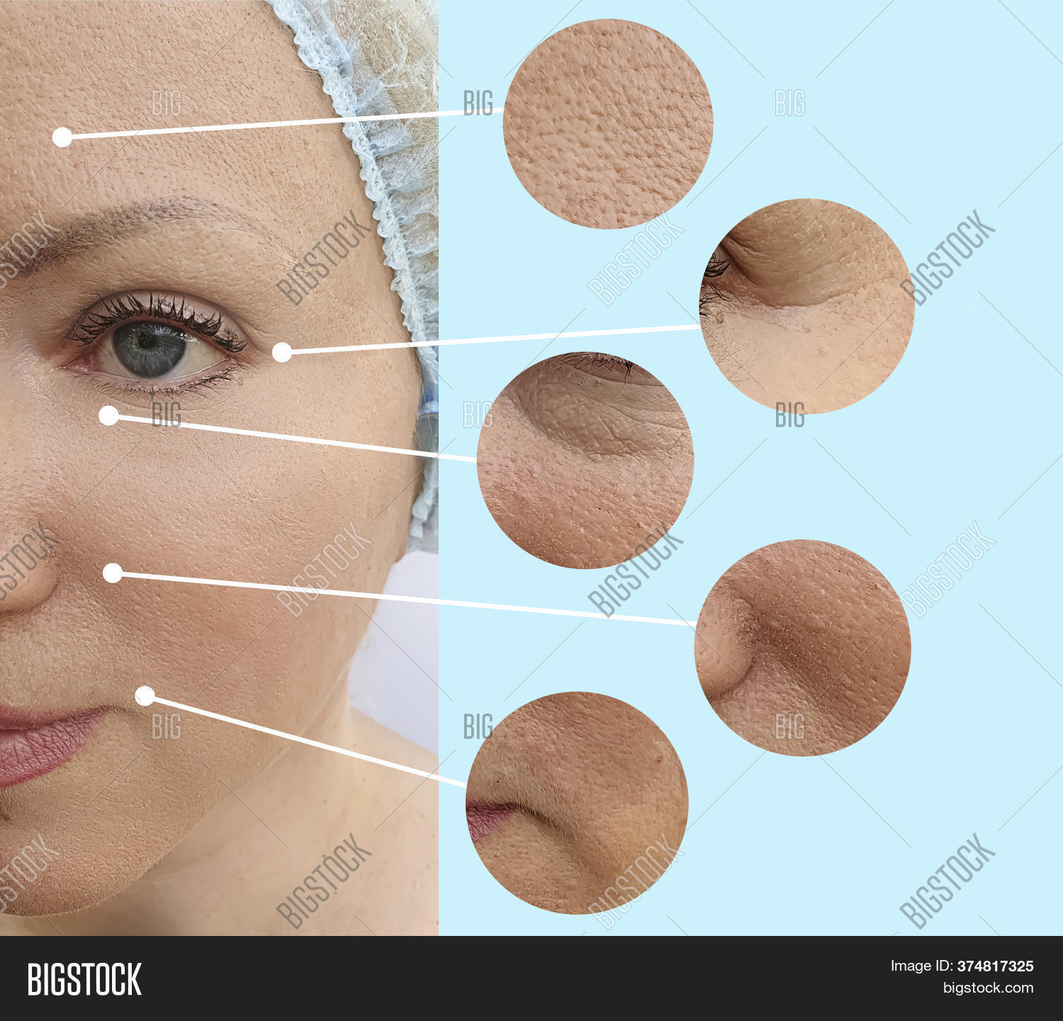 Woman Face Wrinkles Image & Photo (Free Trial) | Bigstock