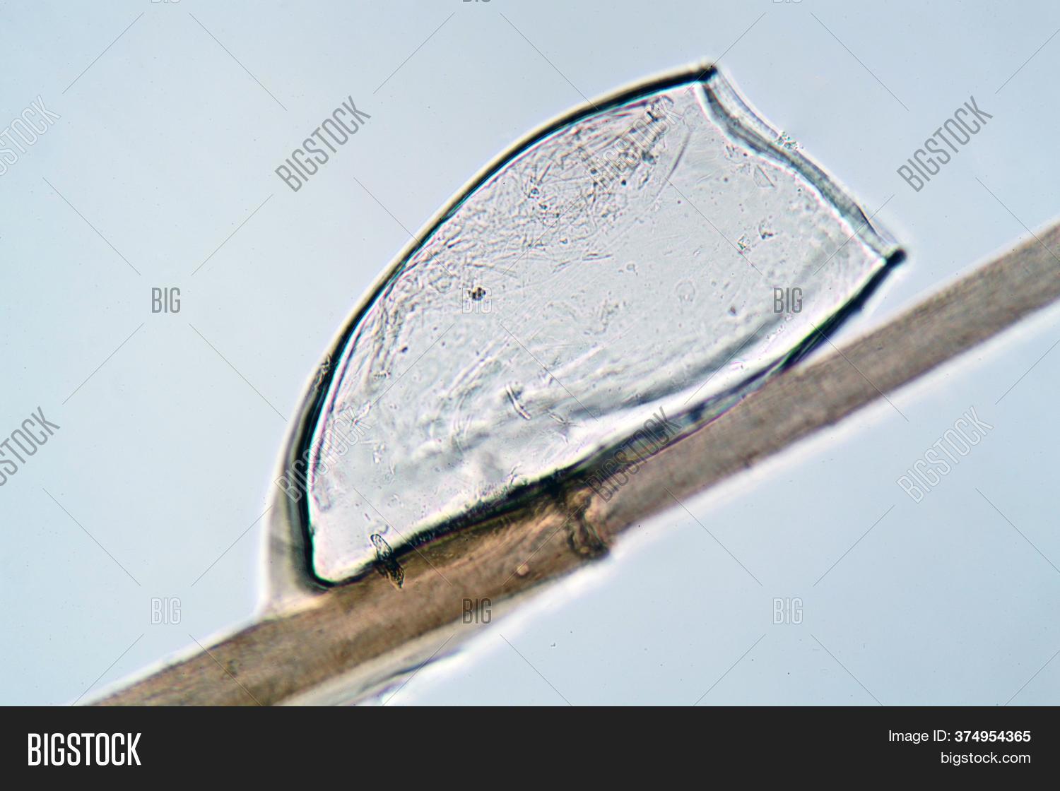 Egg Nit Head Louse, Image & Photo (Free Trial) | Bigstock