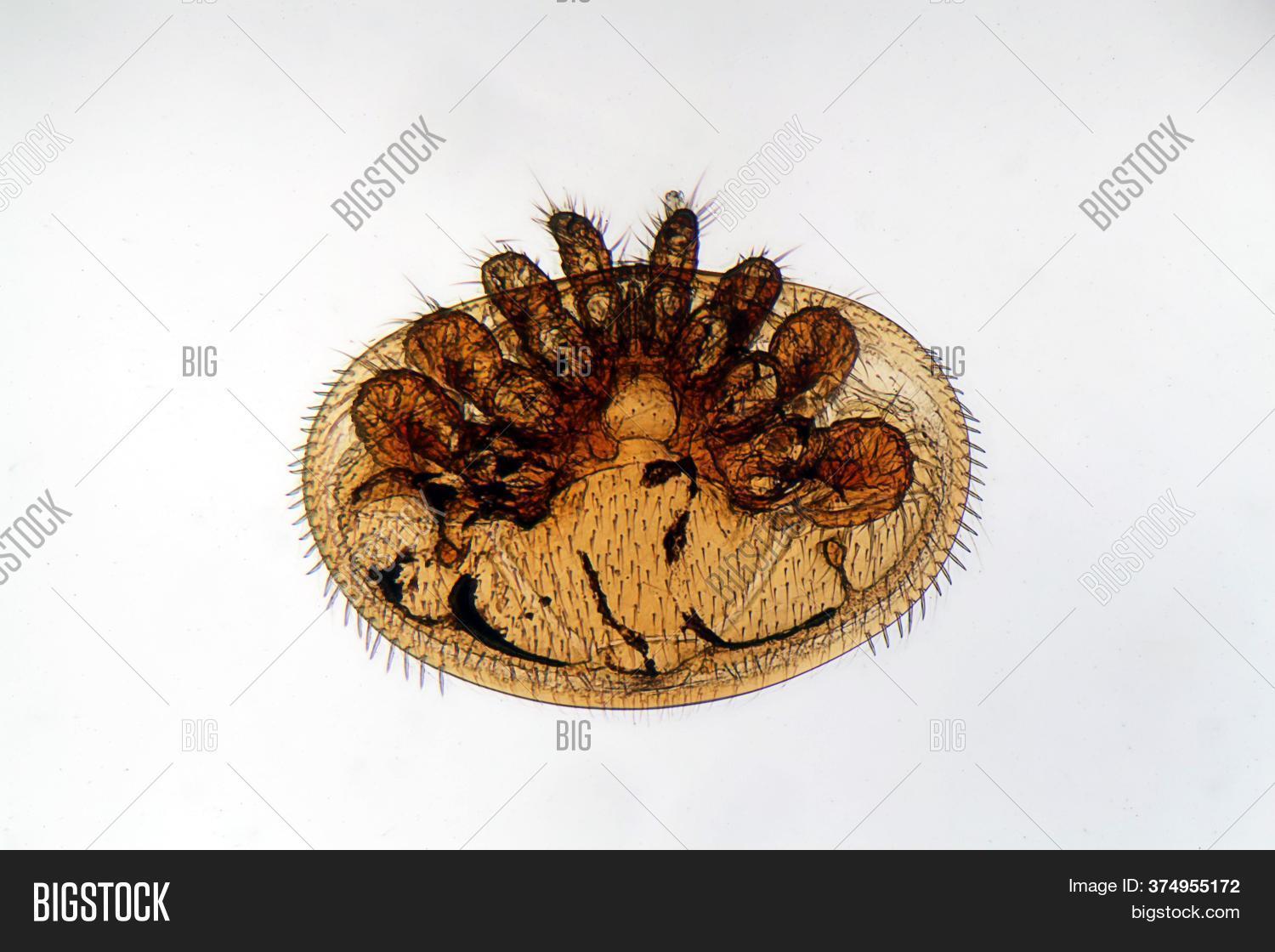 Varroa Mite, Varroa Image & Photo (Free Trial) | Bigstock