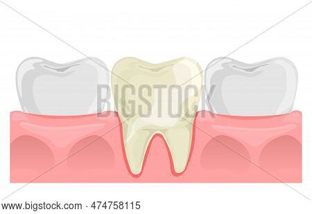 Yellow Tooth Flat Vector & Photo (Free Trial) | Bigstock