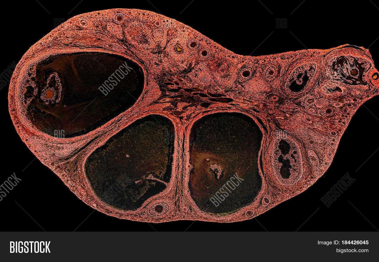 Light Micrograph Ovary Image & Photo (Free Trial) | Bigstock