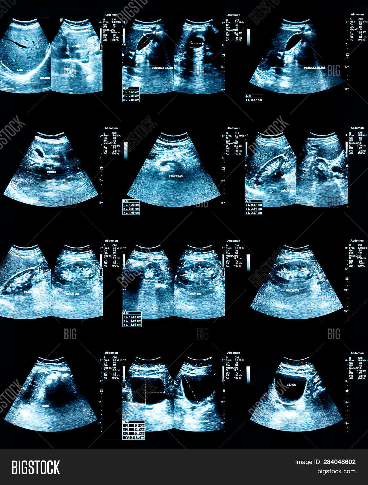 Ultrasound Scan Image Image & Photo (Free Trial) | Bigstock