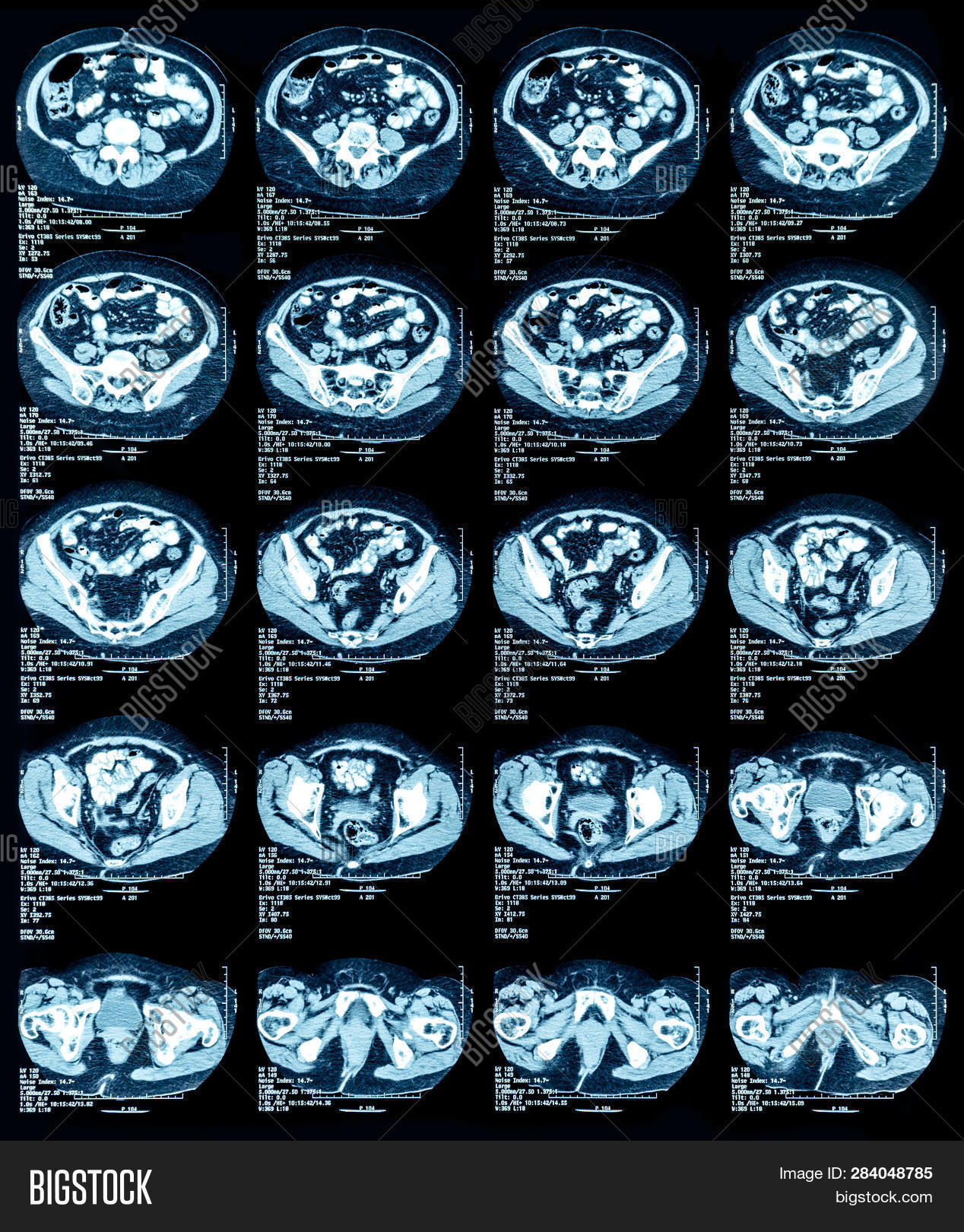 Imagen y foto Mri Scan Image (prueba gratis) | Bigstock