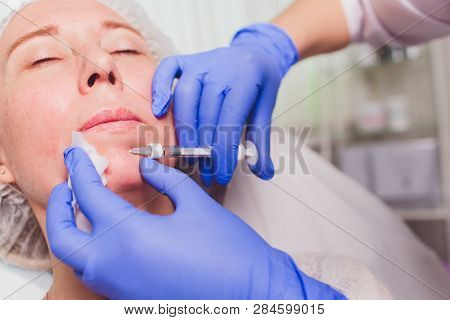 Beauty Woman Botox Image & Photo (Free Trial) | Bigstock