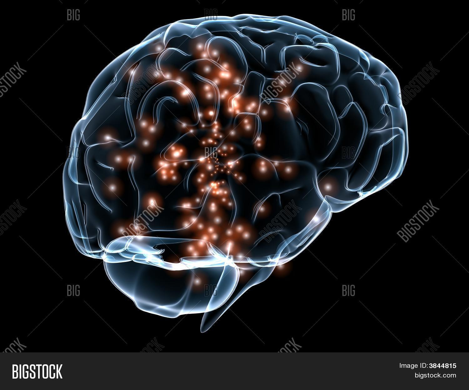 Active Brain Image & Photo (Free Trial) | Bigstock