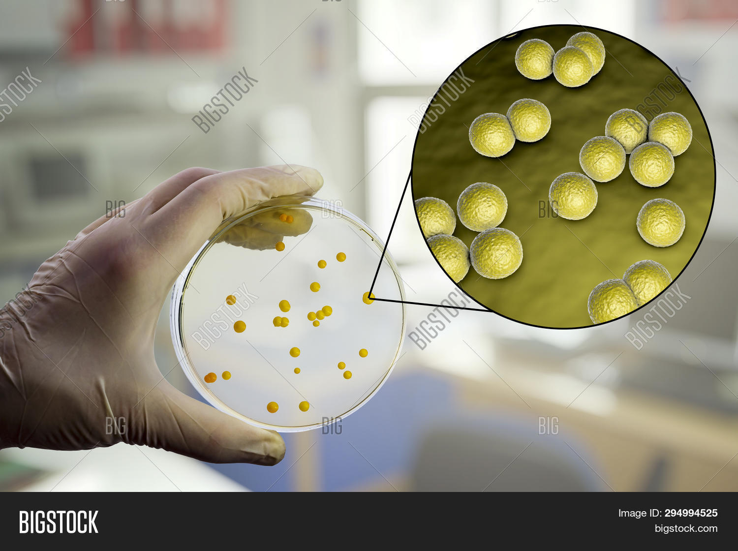Colonies Micrococcus Image & Photo (Free Trial) | Bigstock