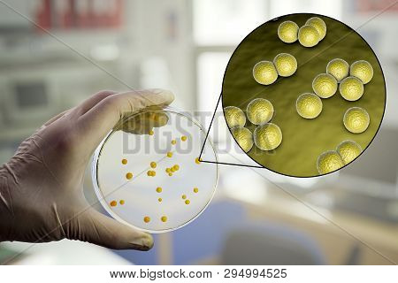 Colonies Micrococcus Image & Photo (Free Trial) | Bigstock