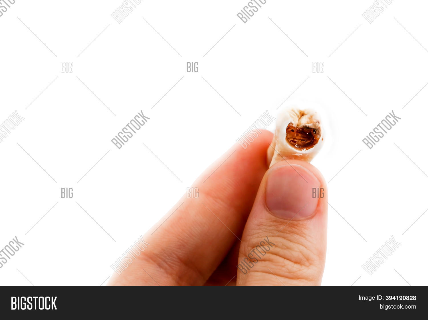 Close Sick Tooth On Image & Photo (Free Trial) | Bigstock