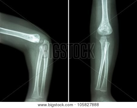 Film X-ray Child 's Image & Photo (Free Trial) | Bigstock