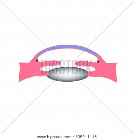 Open-angle Glaucoma. Image & Photo (Free Trial) | Bigstock