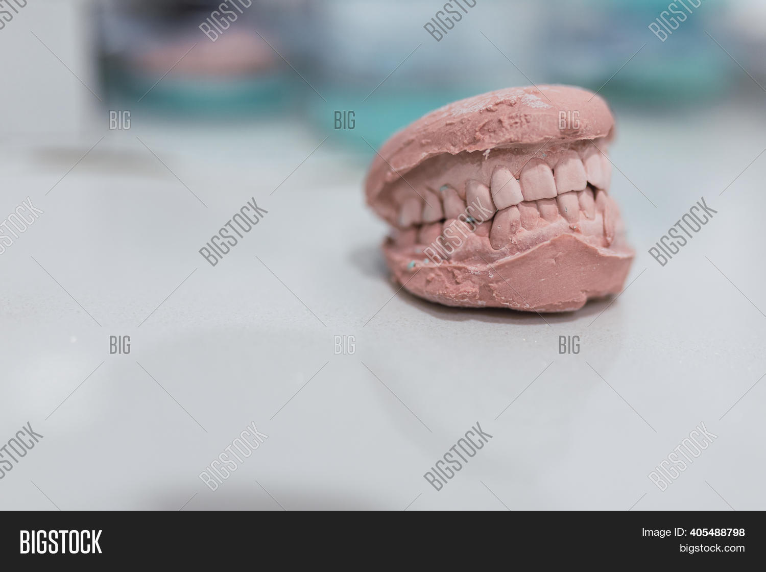 Dental Casting Gypsum Image & Photo (Free Trial) | Bigstock