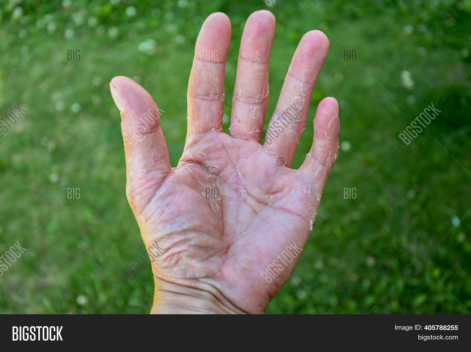 Male Hand Cracked Image & Photo (Free Trial) | Bigstock