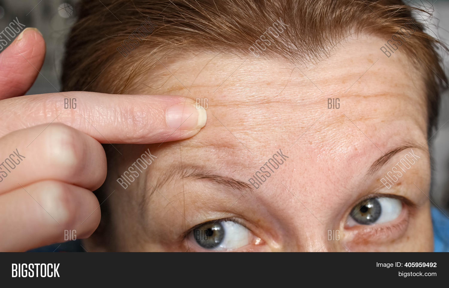 Female Forehead Image & Photo (Free Trial) | Bigstock