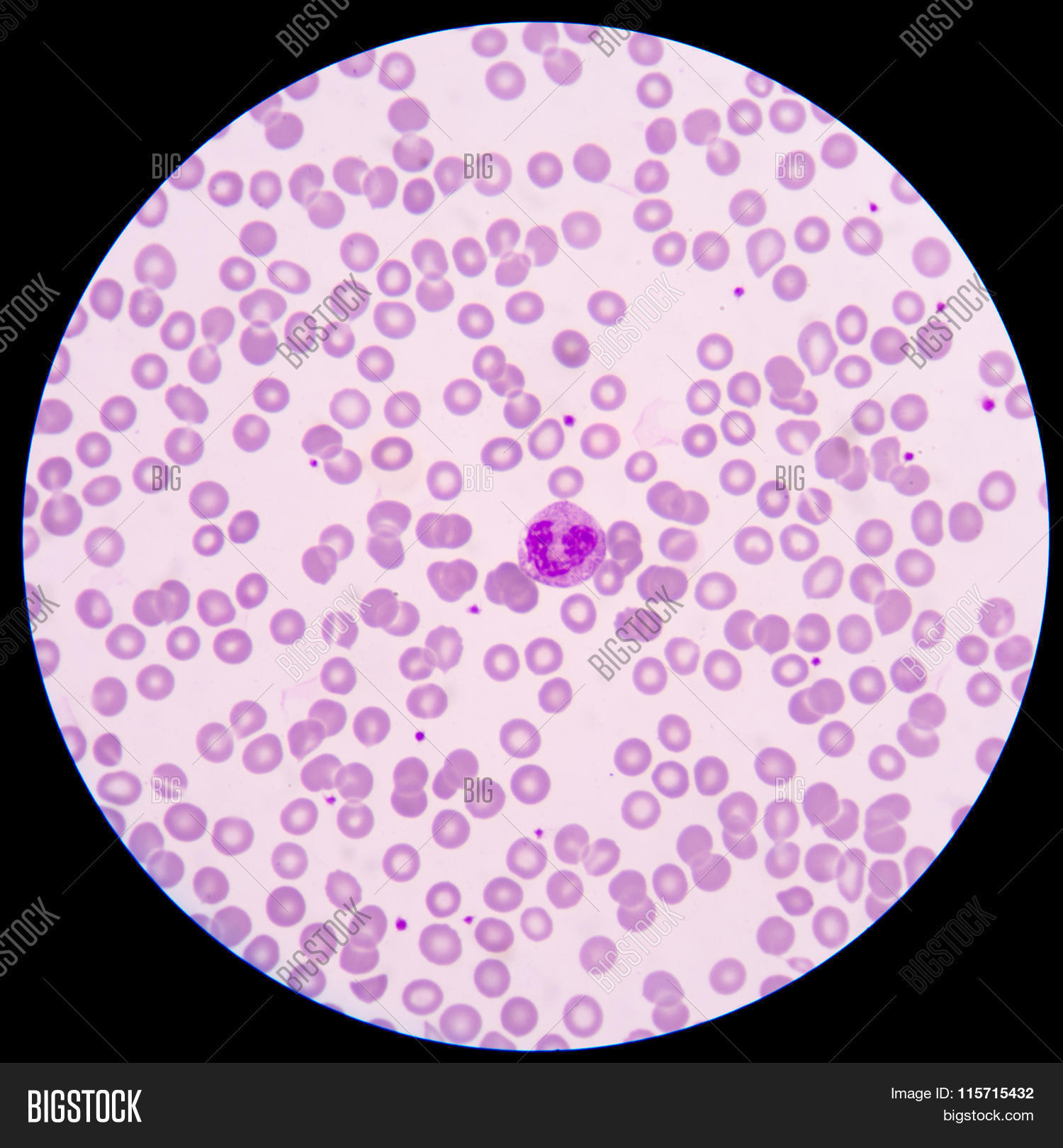 Blood Smear Image & Photo (Free Trial) | Bigstock