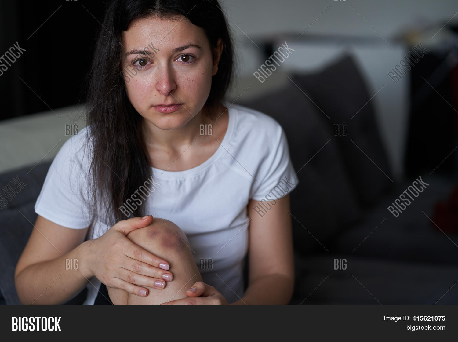 Portrait Beaten Woman Image & Photo (Free Trial) | Bigstock