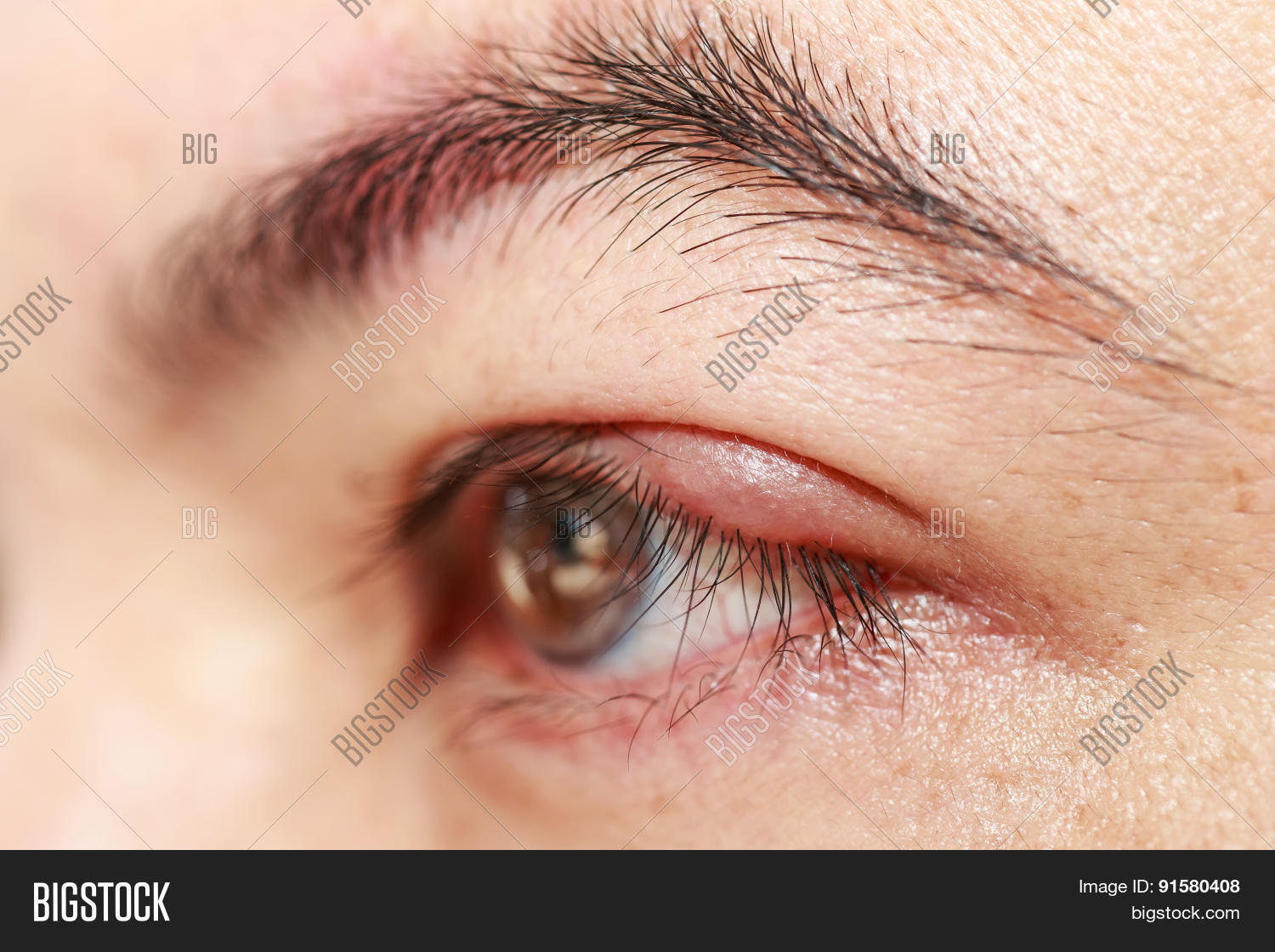 Left Upper Eye Lid Image & Photo (Free Trial) | Bigstock
