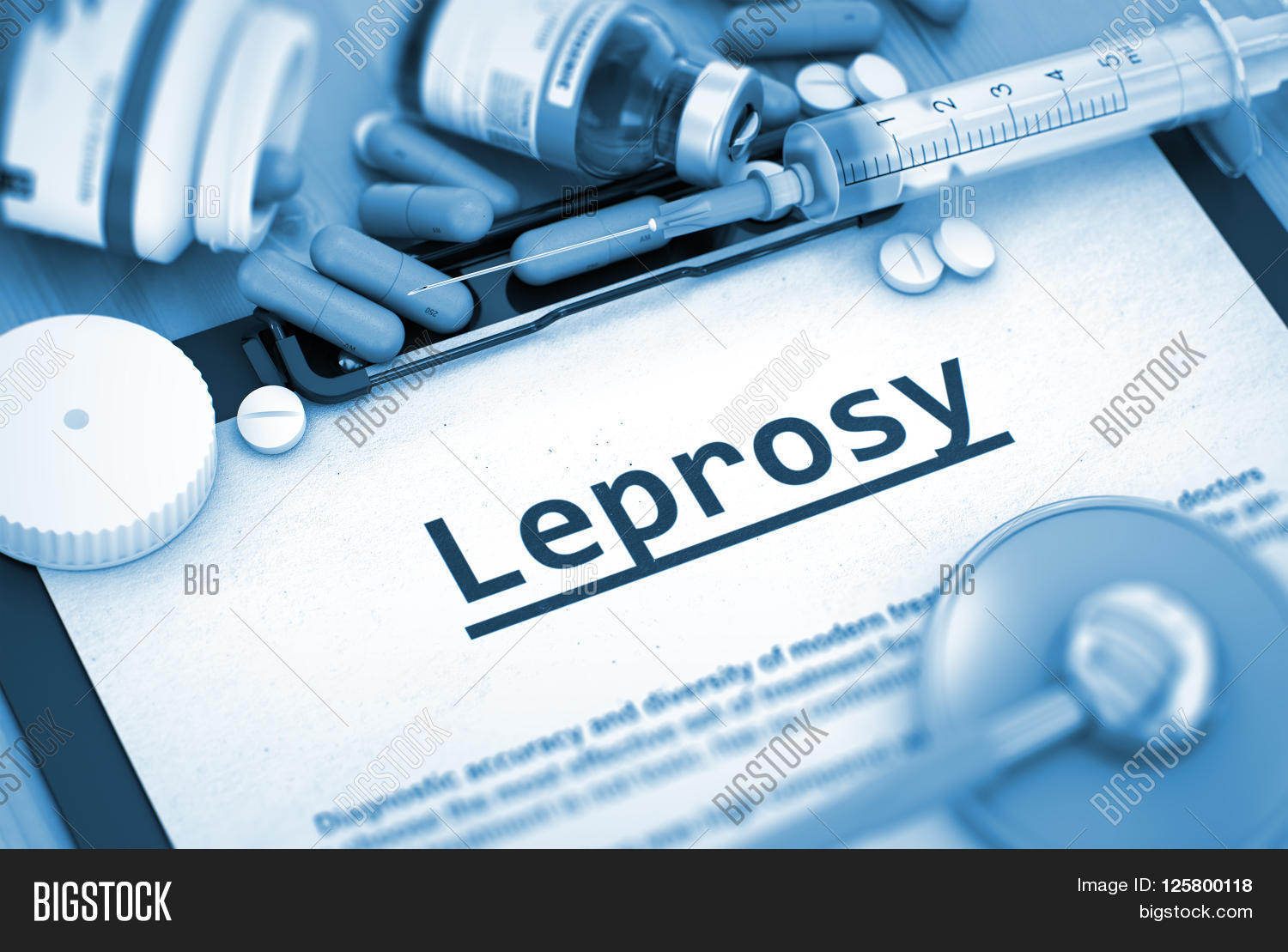 Leprosy - Medical Image & Photo (Free Trial) | Bigstock