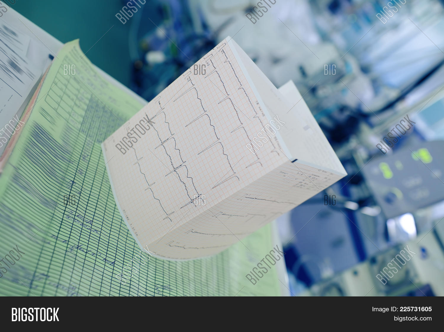 Ecg Medical Test Image & Photo (Free Trial) | Bigstock