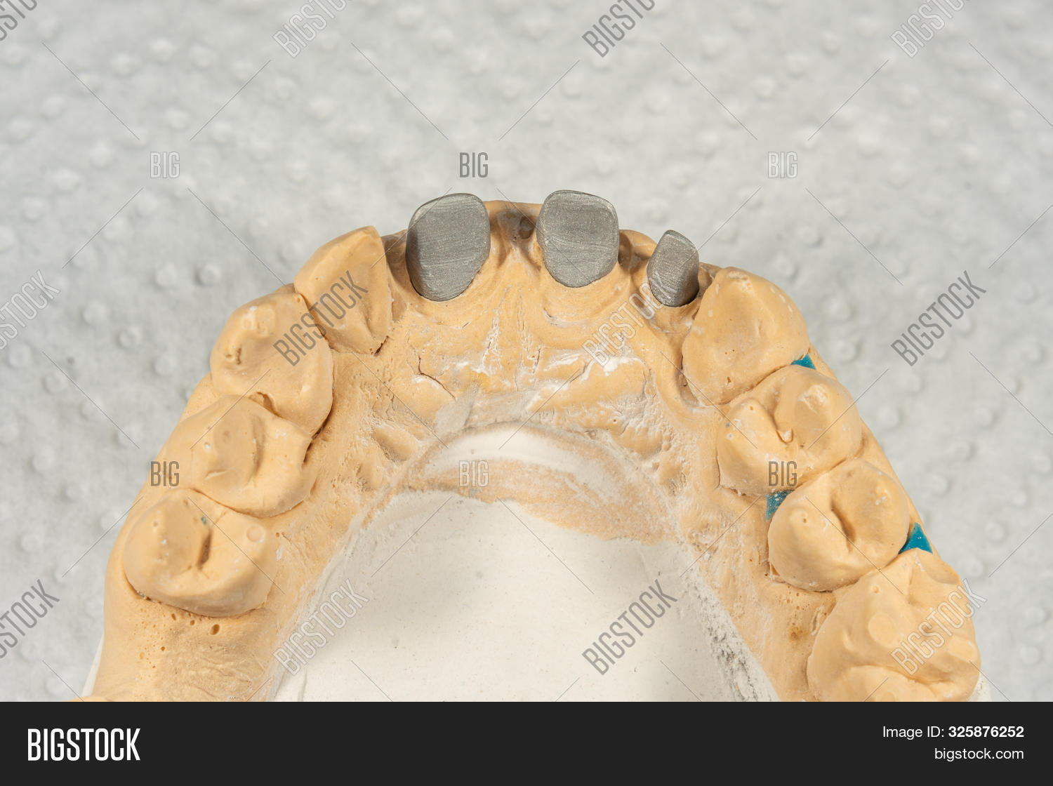 Metal Cast Pin Human Image & Photo (Free Trial) | Bigstock