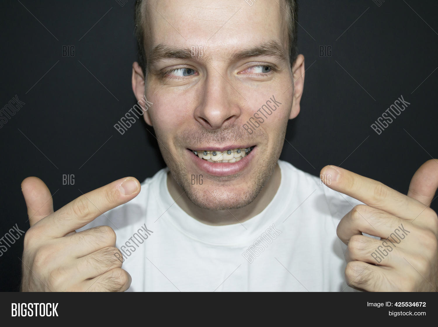 Mans Smile Braces On Image & Photo (Free Trial) | Bigstock
