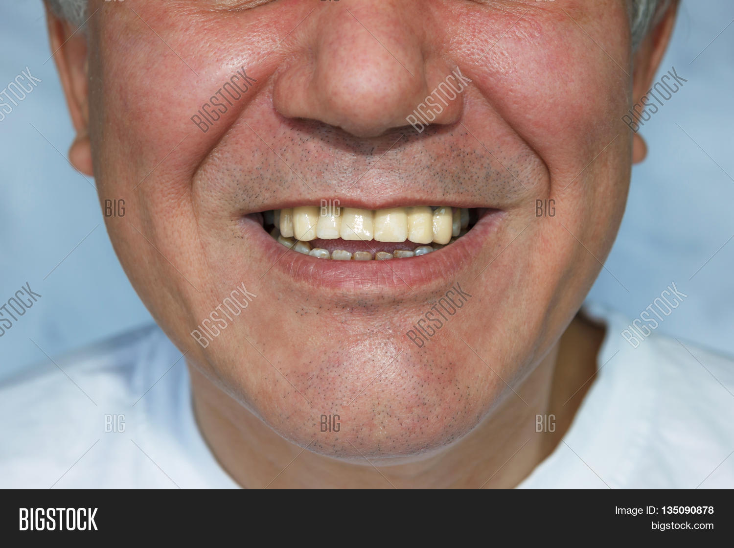 Man False Teeth Image & Photo (Free Trial) | Bigstock