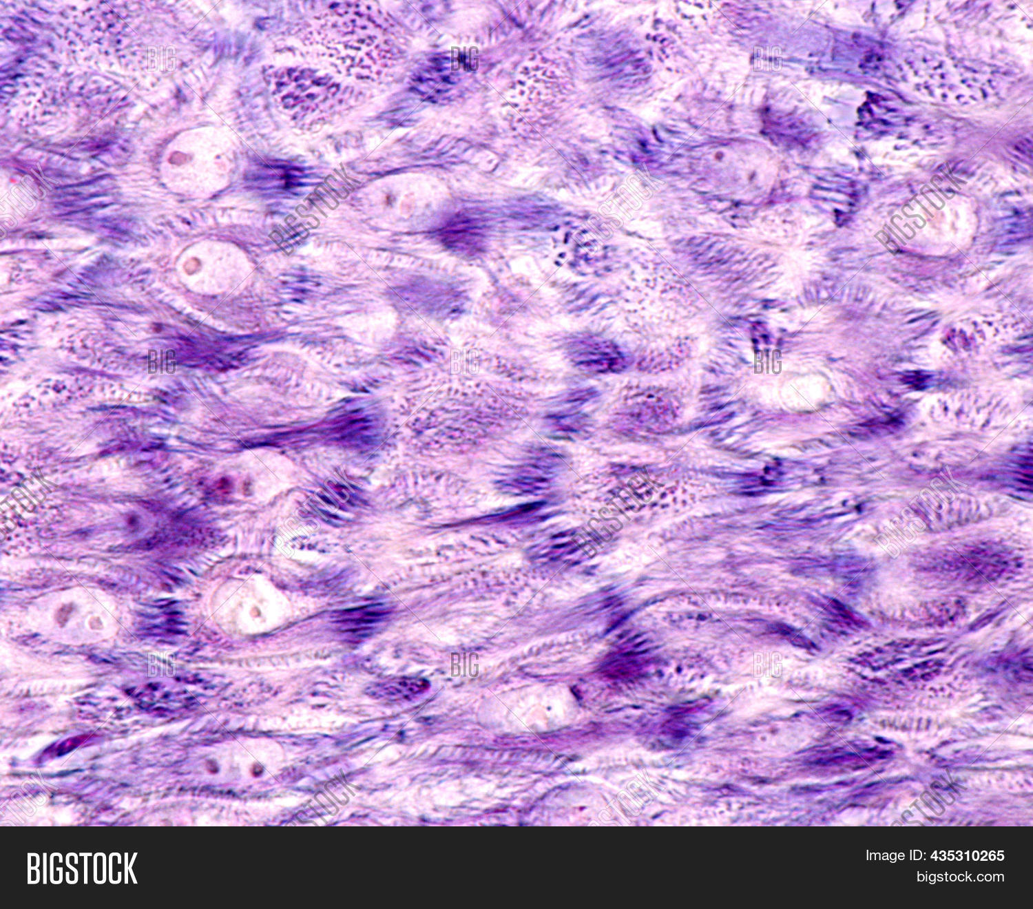 Stratum Spinosum Image & Photo (Free Trial) | Bigstock