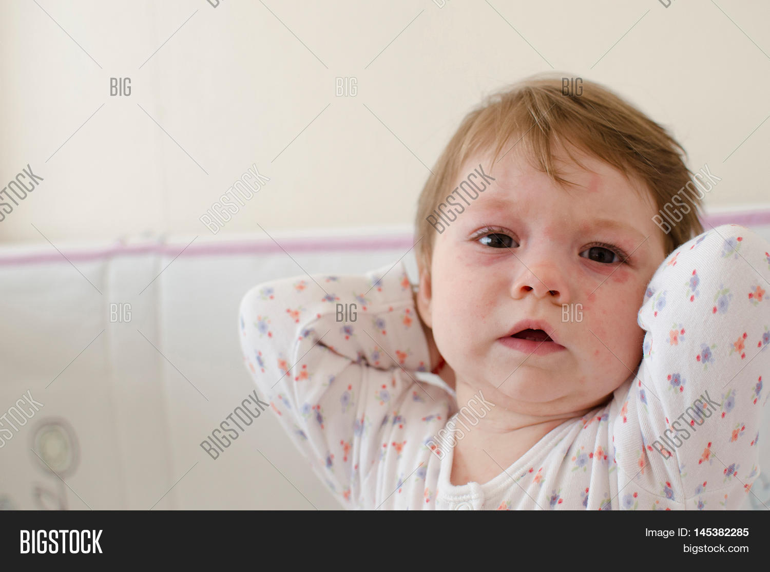 Roseola Infantum Image & Photo (Free Trial) | Bigstock