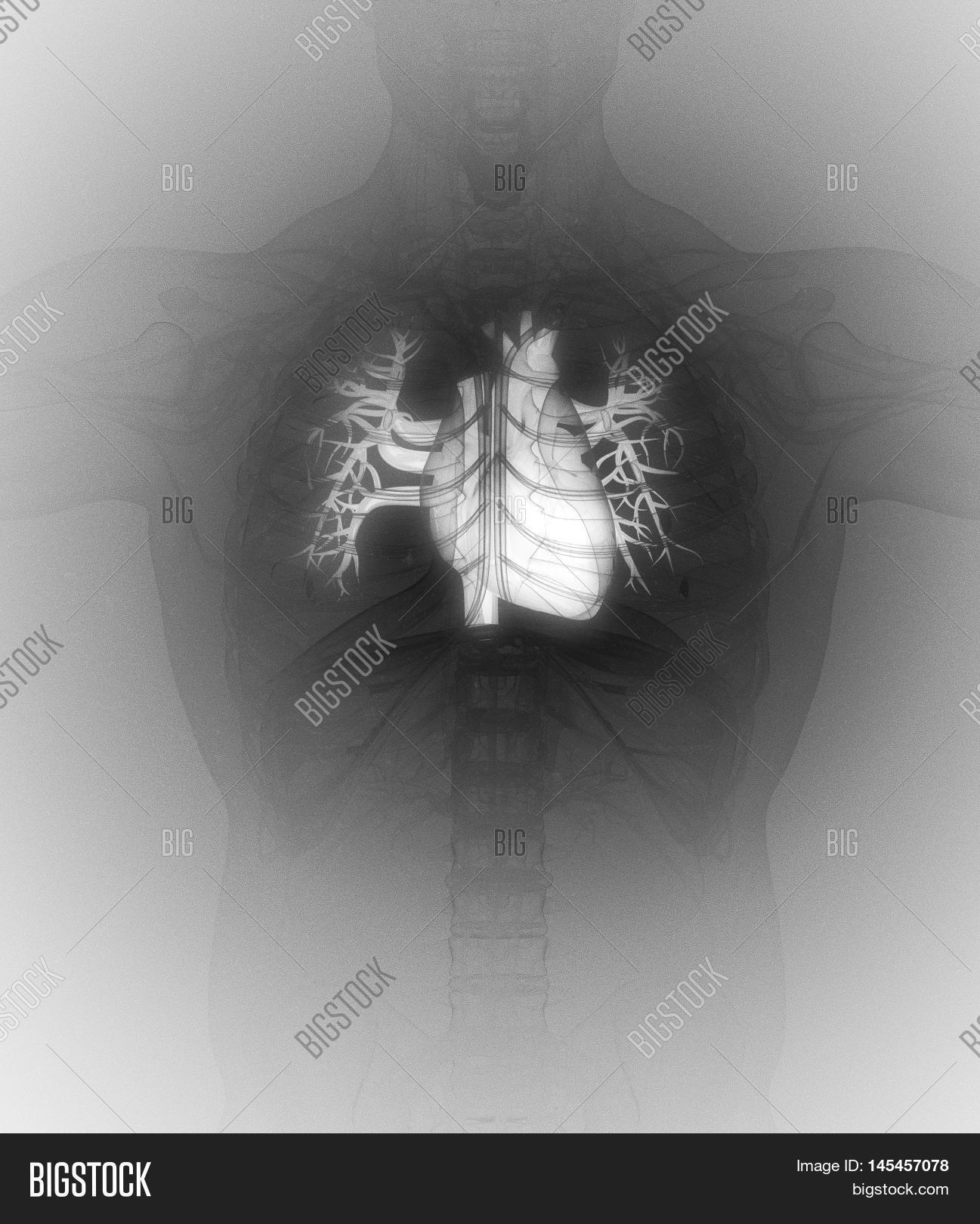 Human Heart. Rib Cage Image & Photo (Free Trial) | Bigstock