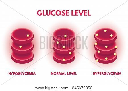 Hyperglycemia, Vector & Photo (Free Trial) | Bigstock