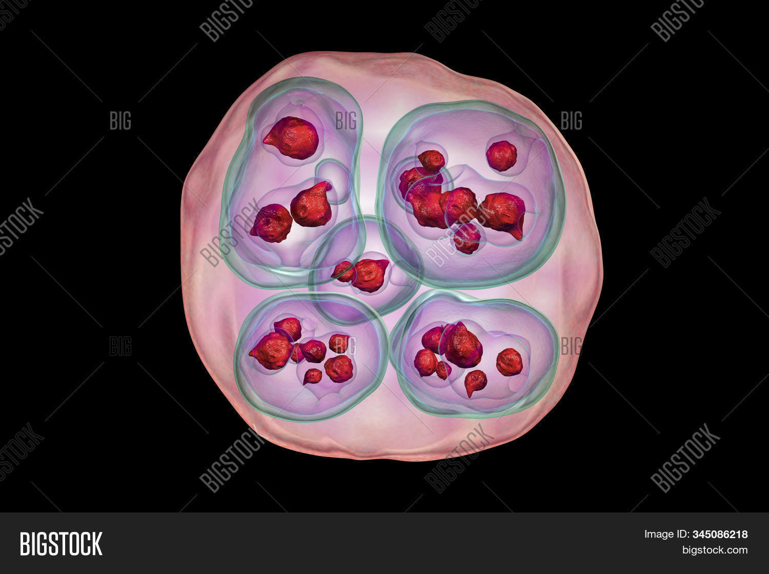 Structure Hydatid Cyst Image & Photo (Free Trial) | Bigstock