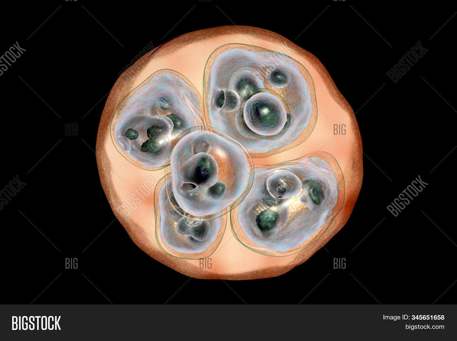 Structure Hydatid Cyst Image & Photo (Free Trial) | Bigstock