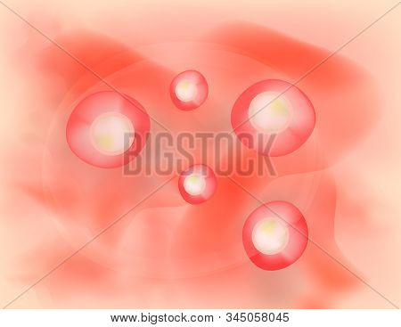 Pustules On Skin. Acne Image & Photo (Free Trial) | Bigstock