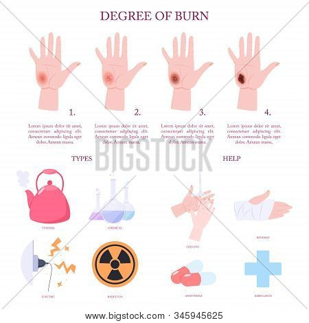 Skin Burn Injury Vector & Photo (Free Trial) | Bigstock