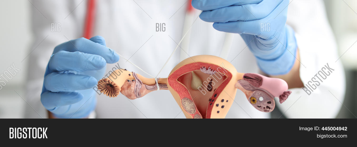 Gynecologist Shows How Image & Photo (Free Trial) | Bigstock