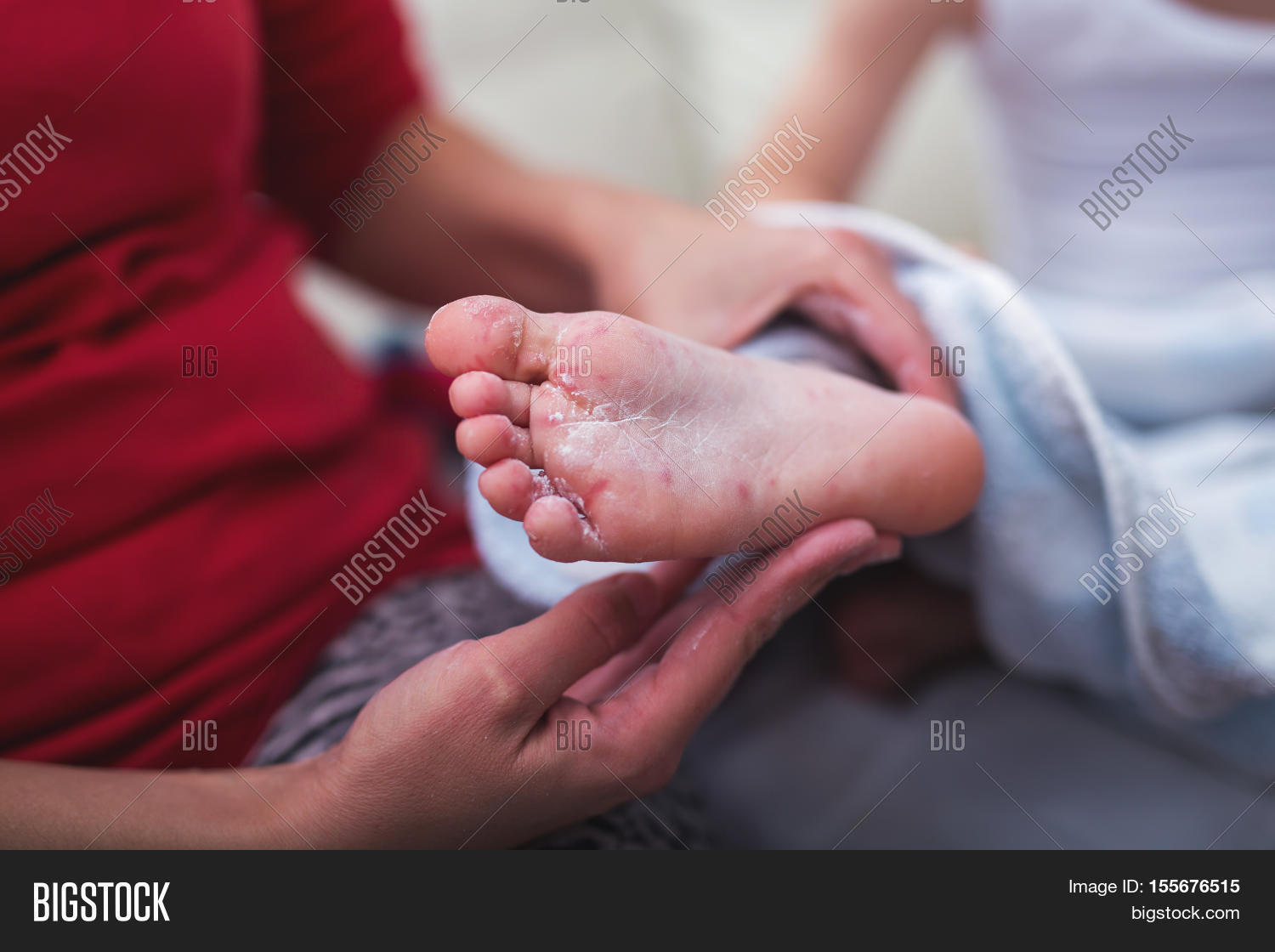 Boy Symptoms Hand Foot Image & Photo (Free Trial) | Bigstock