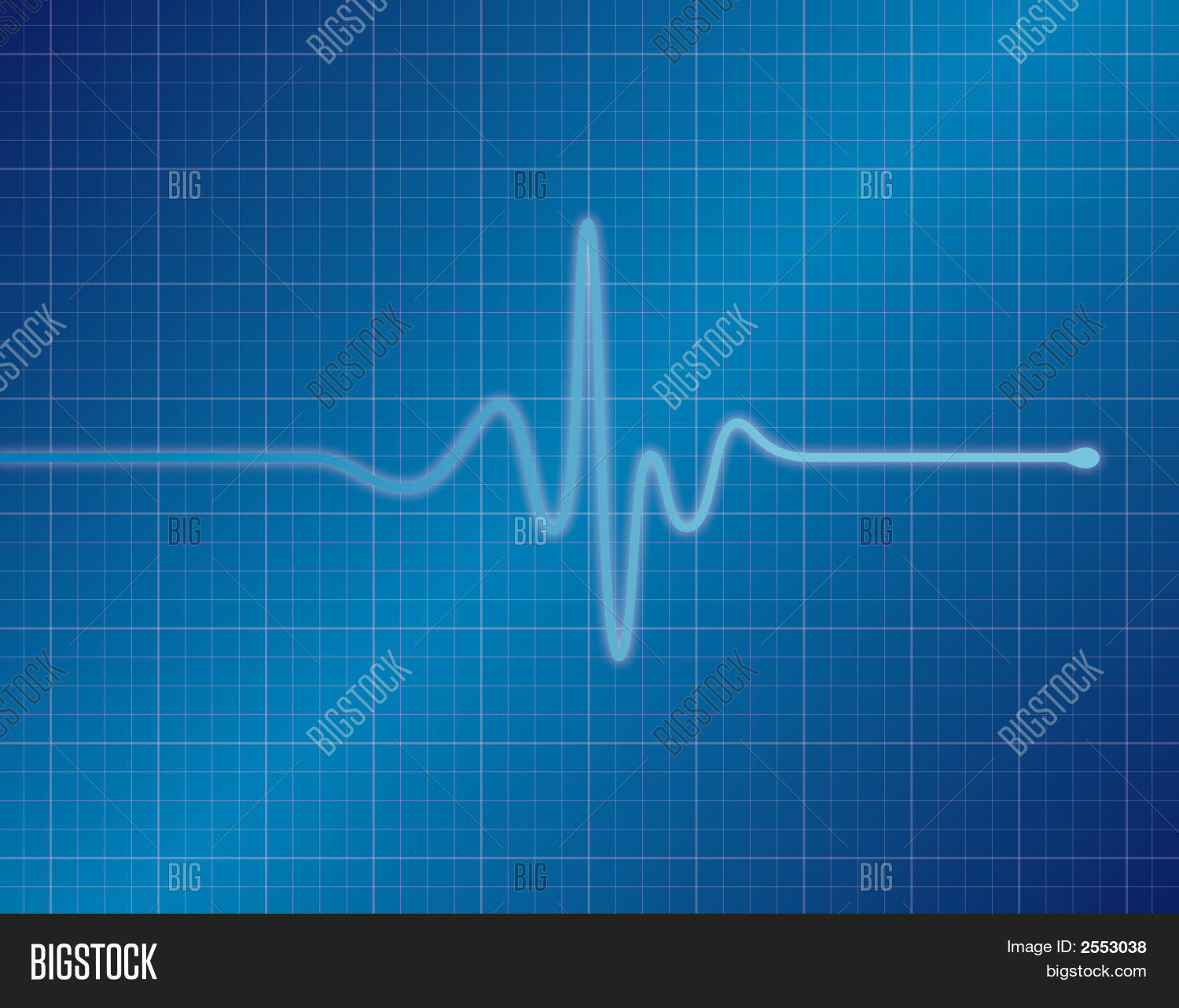 Ekg - Blue Image & Photo (Free Trial) | Bigstock
