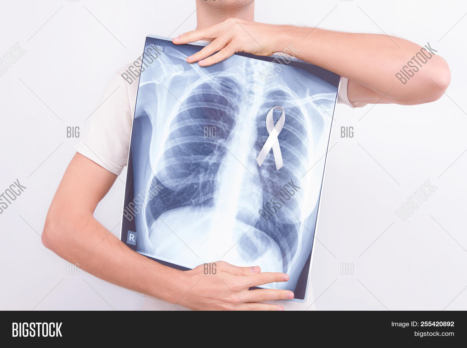 Oncological Lung Image & Photo (Free Trial) | Bigstock